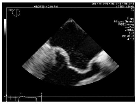 超声图像 超声成像 T图像 第4页 大山谷图库