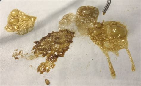 Crc Media Volumes How Do You Calculate How Much Media To Use In Your Crc Column Pre Post