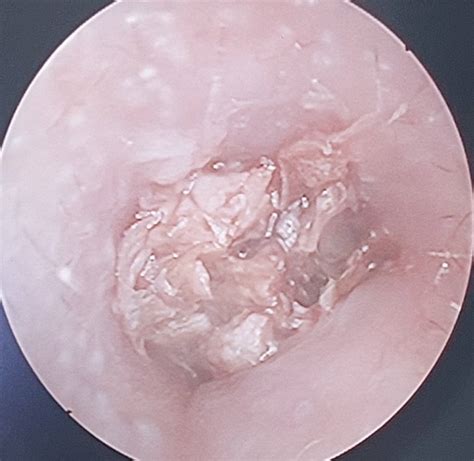 ត្រចៀក ច្រមុះ បំពង់ក ខេត្តបាត់ដំបង