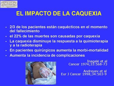 Descubren La Causa De Un Tercio De Las Muertes De Pacientes De Cáncer