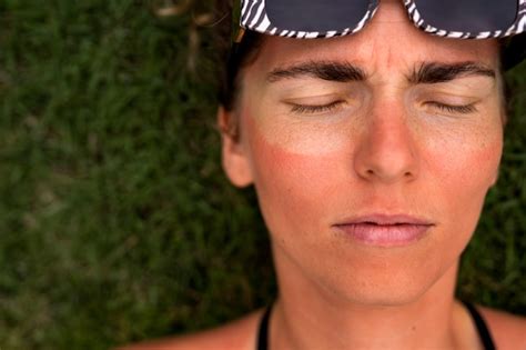 Free Photo View Of Young Girl With Sunburn Skin At The Beach