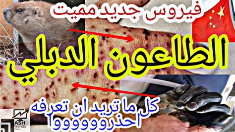 الطاعون الدبلي كل ما تريد ان تعرفه منظمة الصحة العالمية تحظر الجميع