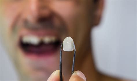 The Importance Of Replacing Your Lost Tooth Dont Ignore It