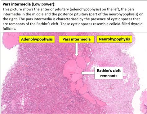 Pituitary Pars Distalis