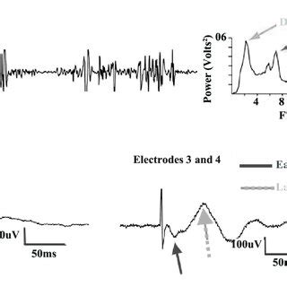 12 A Raw ECoG Recording And Power Spectra Between Two Electrodes Download Scientific Diagram