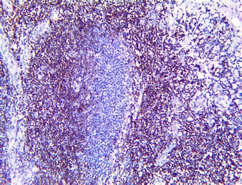 Cd4 Antibody Bsb 179 Bio Sb