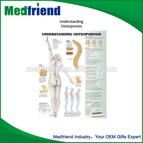 China Wholesale Custom Understanding Osteoporosis Chart High Quality