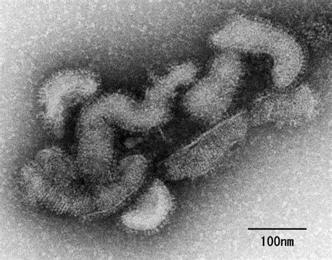 Virus Oz Provoca Primera Muerte En Japón ¿qué Es Síntomas Y Cómo Se