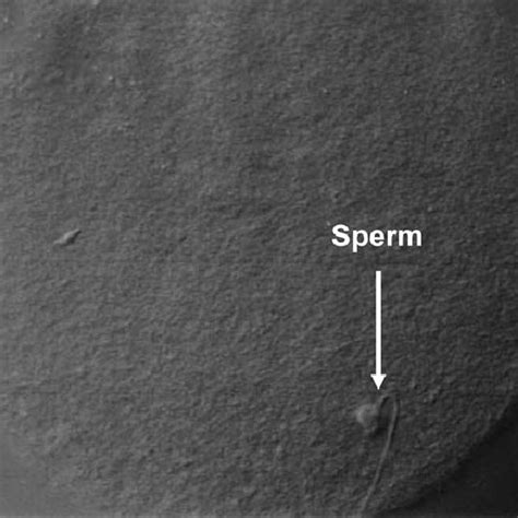 Differential Interference Contrast Image Of Failed Fertilization In A