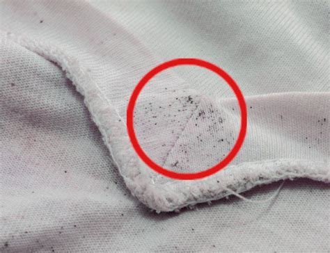 20 Como Sacar Los Hongos De La Ropa Ideas