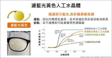 鄭宇庭眼科醫師｜dr Jeng 濾藍光黃色人工水晶體：白內障手術後優缺點都告訴你