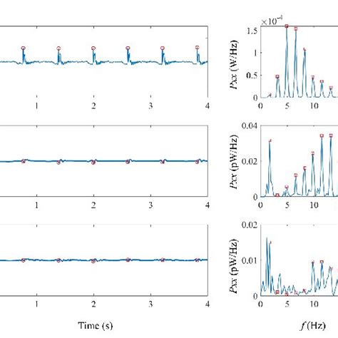Pdf Removal Of Ecg Artifacts From Eeg Using An Effective Recursive