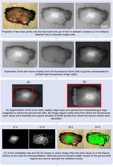 Image Processing Flow Chart Demonstrating Image Scale Extraction Dark Download Scientific
