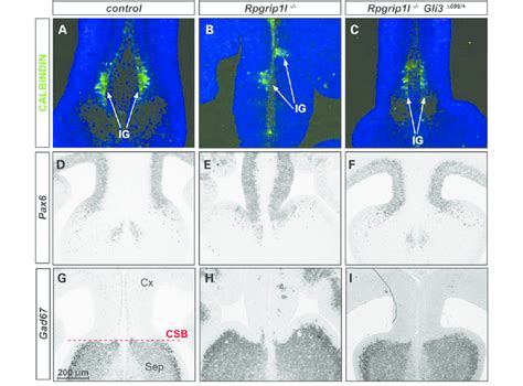 Rescue Of Medial Dv Patterning Defects By Expressing Gli3r In Rpgrip1l