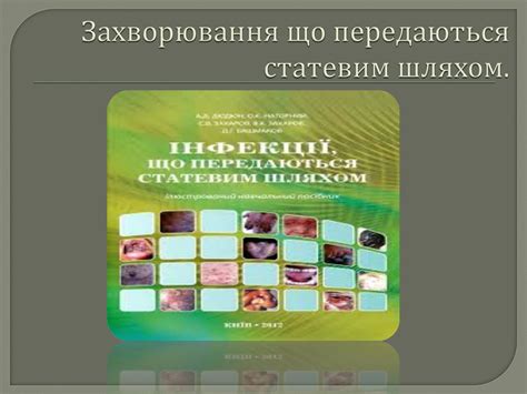 Презентація на тему Захворювання що передаються статевим шляхом