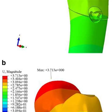 Abbreviations Fea Finite Element Analysis Znn Zimmer Natural Nail Download Scientific