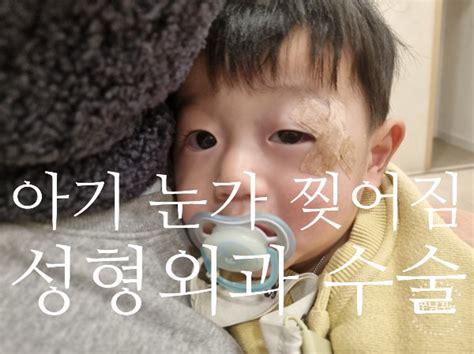 13개월 아기 눈가 찢어짐 성형외과 봉합수술 네이버 블로그