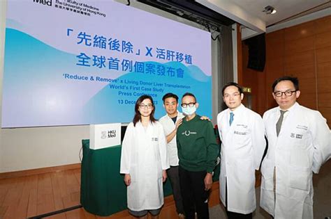 肝癌治療全球首例港大醫學院創先縮後除配以活肝移植根治末期肝癌 生活易ESDlife LINE TODAY