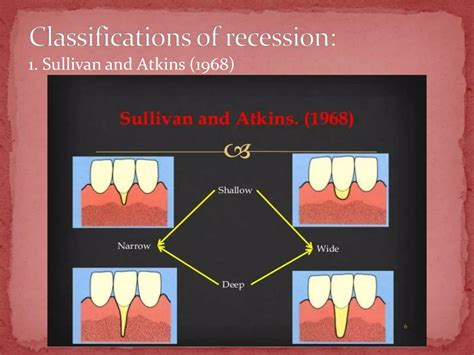 Clinical Examination Of Gingiva Pptx