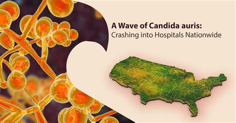 Candida Auris What To Know About The Fungal Infection Spreading Across