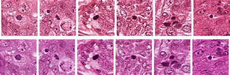 Figure 333 From Automated Mitosis Detection In Color And Multi