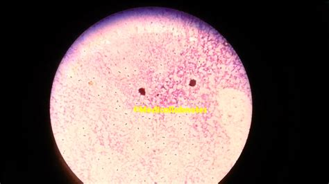 Cerebrospinal Fluid Csf Culture And Sensitivity Introduction