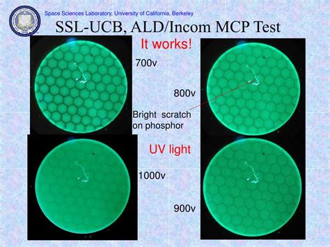 Ppt Ssl Ucb Ald Incom Mcp Test Powerpoint Presentation Free
