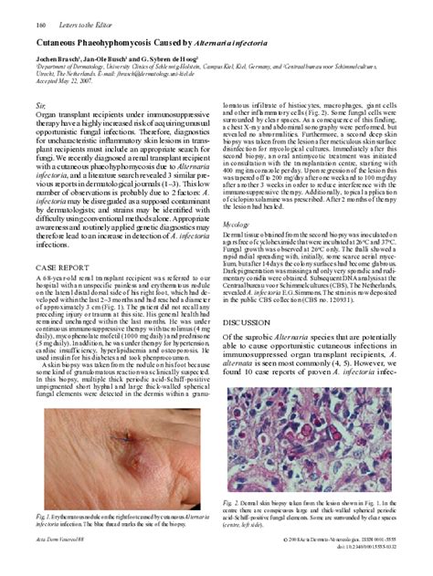 Pdf Cutaneous Phaeohyphomycosis Caused By Alternaria Infectoria