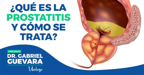 ¿qué Es La Prostatitis Y Cómo Se Trata Dr Gabriel Guevara