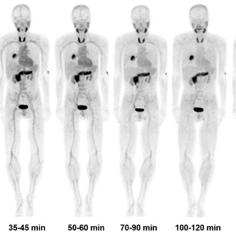 The Average 3 H Time Activity Curves Tacs From 9 Participants Of 68 Download Scientific