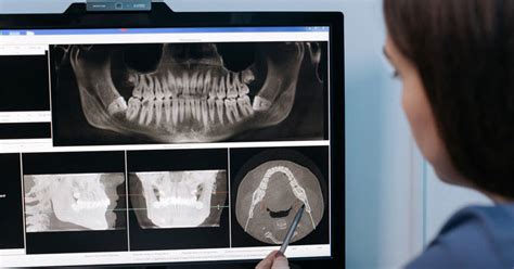 Best Oral Surgery Assistant Interview Questions Fixed Career