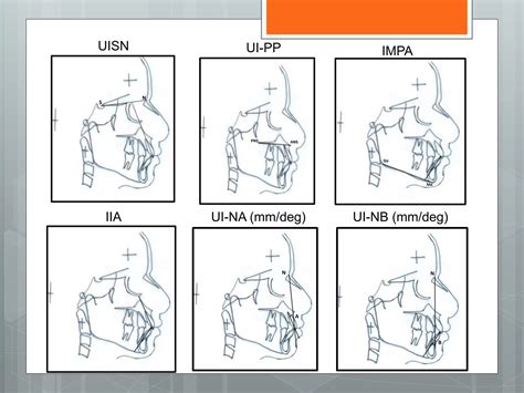 Cephalometry Ppt