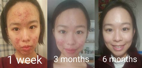 10000 Best R Skincareaddiction Images On Pholder [psa] [sun Care
