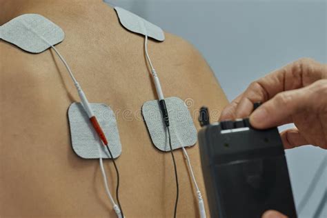 1414 Fotos De Stock De Eletro Terapia Fotos De Stock Gratuitas E Sem