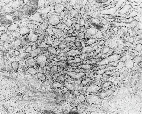 Smooth Endoplasmic Reticulum Drawing