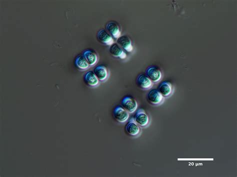 Chroococcus