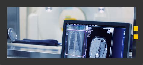 Understanding Myocardial Viability Pet Scans What To Know