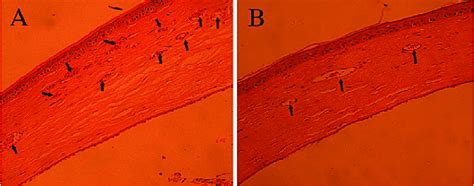 Photomicrographs Of Corneal Neovascularization 14 Days Post Download Scientific Diagram