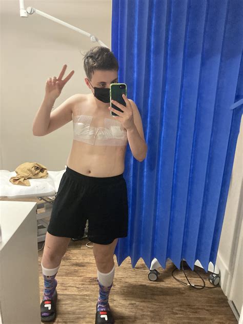 How Long Did You Wait To Have Sex After Top Surgery Rtopsurgery