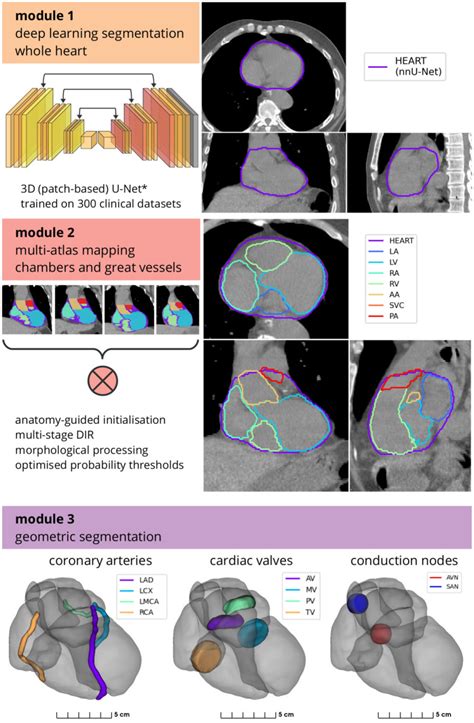 Open Source Fully Automated Hybrid Cardiac Substructure Segmentation