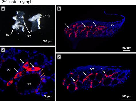 Cockroach Bacteriocytes Migrate Into The Ovaries For Vertical