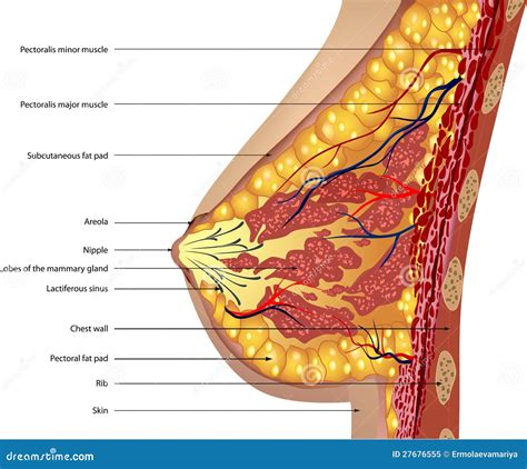 Breast Abscess Cross Section Of The Female Chest With Inflammation