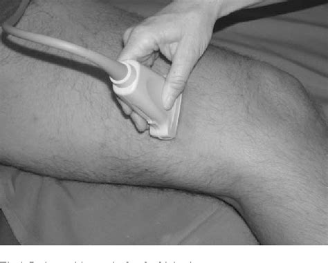 Figure 1 From Ultrasound Guided Infrapatellar Nerve Block In Human