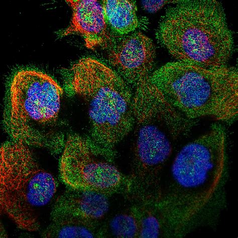 Subcellular Itga3 The Human Protein Atlas