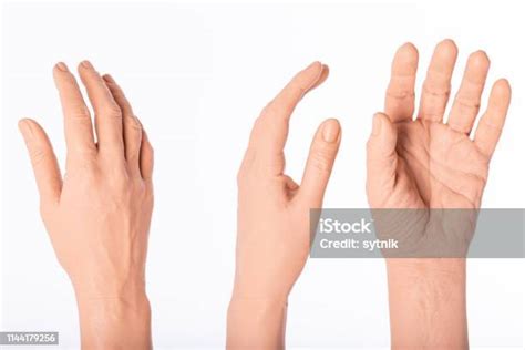 사람을 위한 그룹 실리콘 보 철물 손 의학 분홍색 임 플 란 트 0명에 대한 스톡 사진 및 기타 이미지 0명 건강관리와