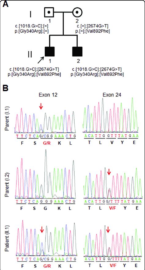 Identification Of Compound Heterozygous Mutations In The Nbas Gene In Download Scientific