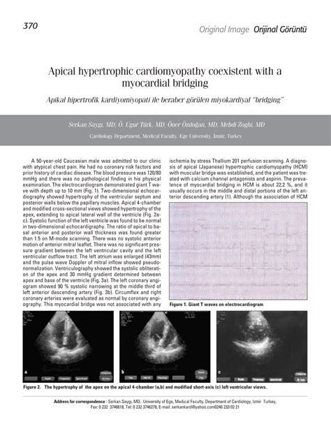 Apical Hypertrophic Cardiomyopathy Coexistent With A Myocardial