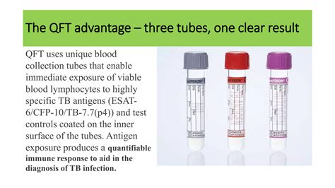 Tb Quantiferon Test Pptx