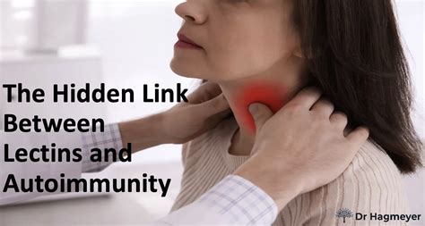 How Food Sensitivities And Food Allergies Fuel Autoimmunity