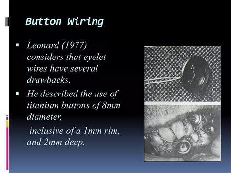 Various Intermaxillary Fixation Techniques Pptx
